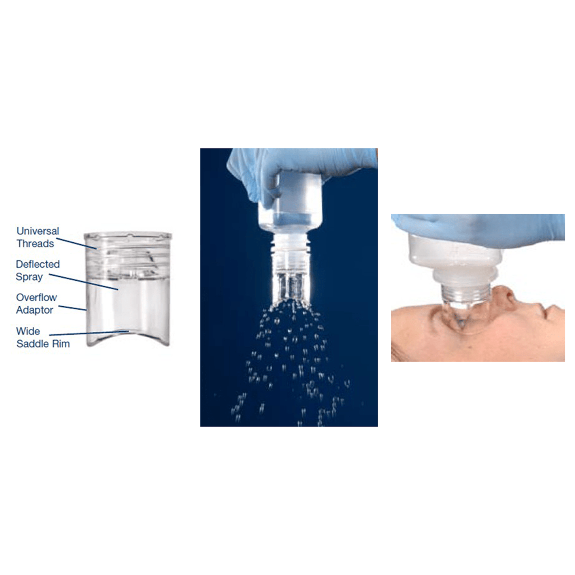 EyeCap™ Eye Irrigation Bottle Shield — CTOMS